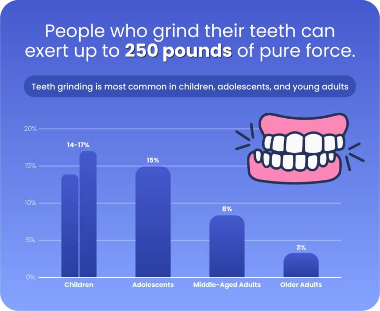 Bruxism: Teeth Grinding at Night | Sleep Foundation